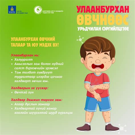 Улаанбурхан өвчний талаар та юу мэдэх вэ Дархан Уул аймаг Санхүүгийн