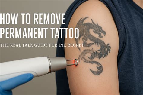 How To Remove Permanent Tattoo The Real Talk Guide For Ink Regret Or