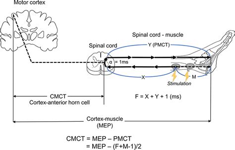 Join Journal Of Intraoperative Neurophysiology