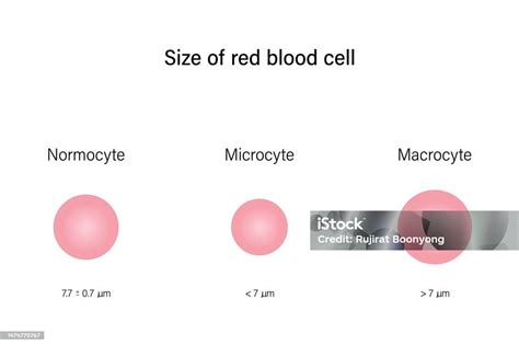 Morfologi Sel Darah Merah Ukuran Sel Darah Merah Anisositosis Ilustrasi