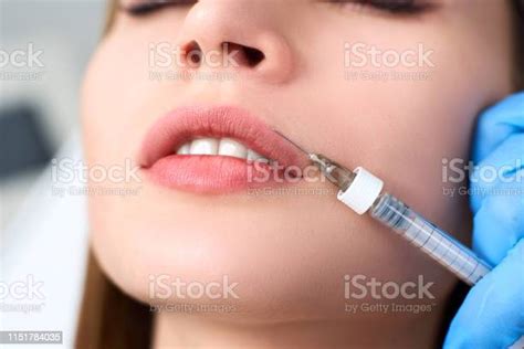 입술 확대 및 윤곽 미용사 의사의 근접 촬영은 주사기와 여성 입술에 아름다움 절차를 하 고 젊은 여자의 입 주사를 받고 미용 치료 Mesotherapy 건강관리와 의술에