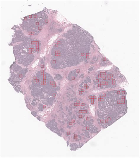 github histolab histolab library for digital pathology image processing
