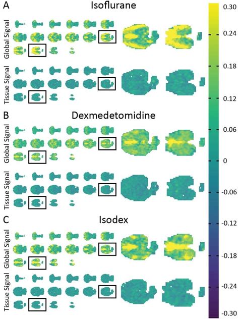 Z Scored Coactivation Patterns Caps To The Global Signal And The Download Scientific Diagram
