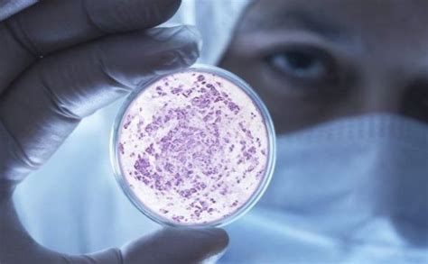 На пляжах області виявили перевищений рівень кишкової палички Решетилівщина Ua