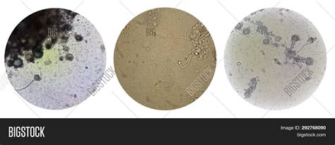 Sexually Transmitted Image Photo Free Trial Bigstock