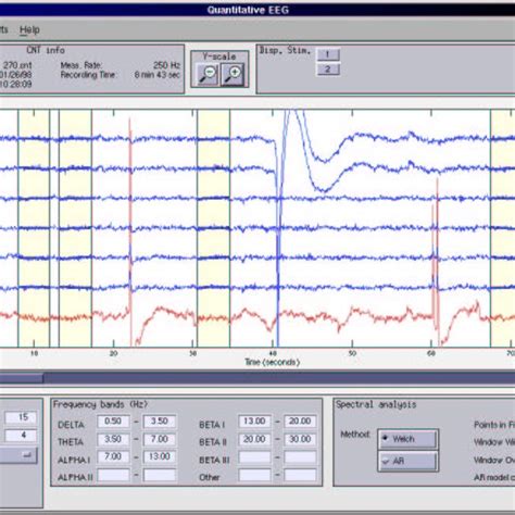 User Interface Of Quantitative EEG Analysis Tool Download Scientific Diagram