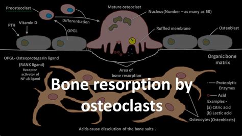 Difference Between Bone Formation And Bone Resorption At Timothy