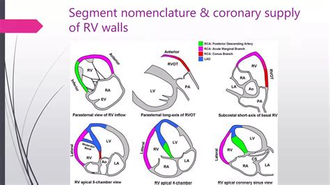 Echo Assessment Of Rv Function Pptx