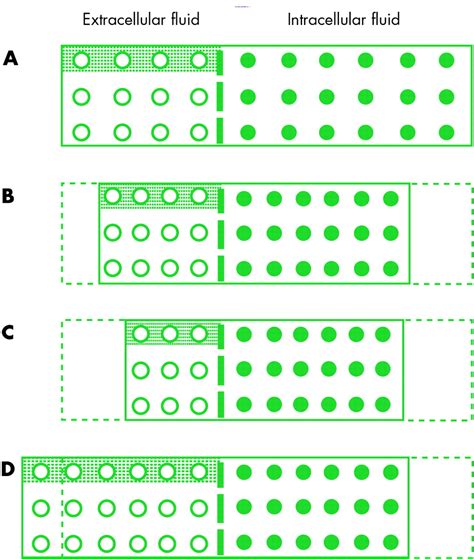 Hypernatraemia Diagnosis And Management Adc Education And Practice Edition