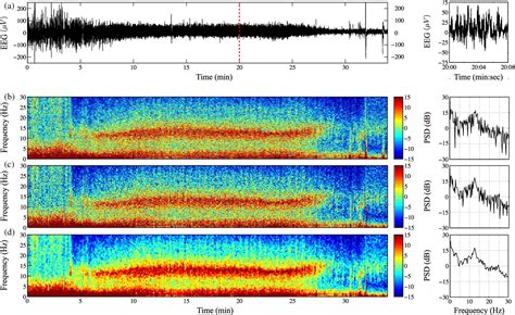 Figure 7 From A Review Of Multitaper Spectral Analysis Semantic Scholar