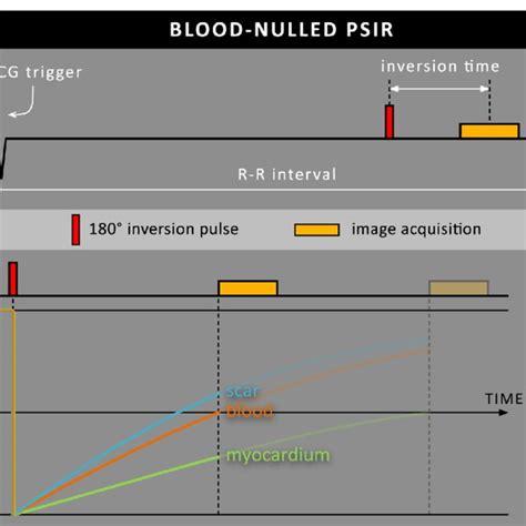 Schematic Overview Of A Standard Phase Sensitive Inversion Recovery