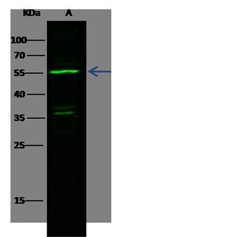 Mst1 Stk4 Antibody Pa5 81048