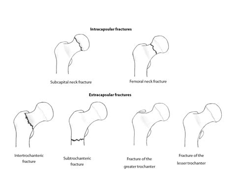 Common Orthopedic Injuries 2017 02 07 Ahc Media