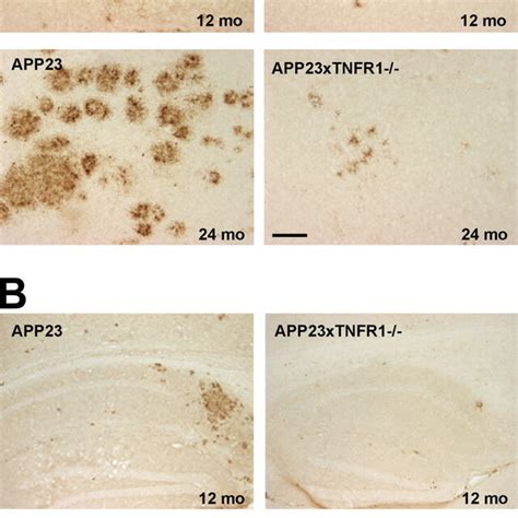 Microglia Activation Is Reduced In The Brains Of App23 Tnfr1− − Mice