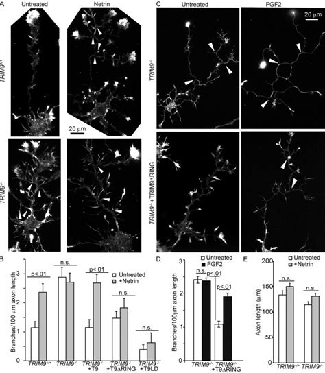 Trim9 Is Required For Netrin 1 Dependent Branching A E15 5 Trim9 Download Scientific