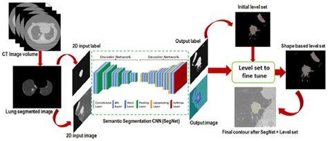 A Review Of Deep Learning Techniques For Lung Cancer Screening And