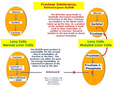 Fructose Intolerance Hereditary Ocular Diseases
