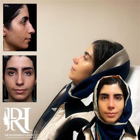 دکتر حمیدرضا راستی متخصص گوش، حلق و بینی جراح بینی دکتر حمیدرضا راستی متخصص گوش، حلق و