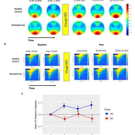 Mean Total Power A Voltage Scalp Topography Maps Are Shown For The