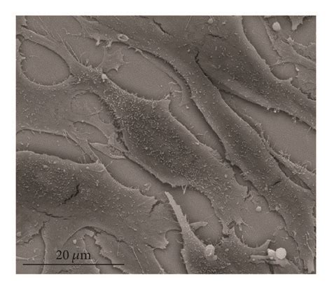 Scanning Electron Microscope Images Of Vaginal Epithelial Cells Treated Download Scientific