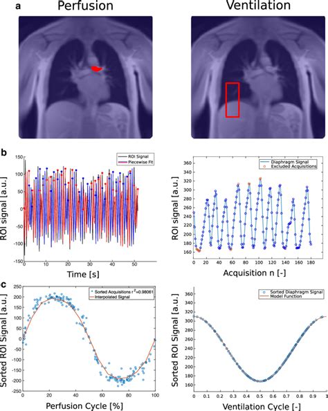 A Example Of A Central Arterial Lung Vessel Segmentation Red Marked Download Scientific