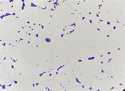 A Case Of Vagococcus Fluvialis Isolated From The Bile Of A Patient With