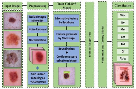 The Proposed Framework For Categorizing Seven Skin Lesions Download Scientific Diagram