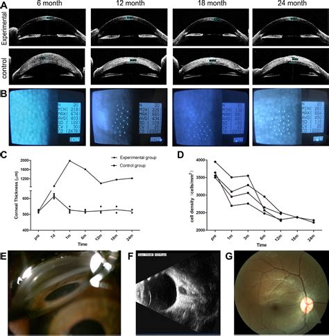 Long Term Observation And Sequencing Analysis Of Skps Derived Corneal Endothelial Cell Like