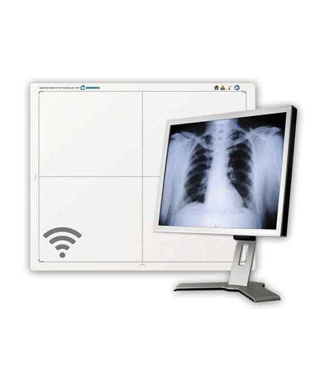 Codonics Horizon GS DICOM Printer Glomeda