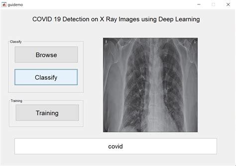 Covid Detection In Xray Images Using Matlab
