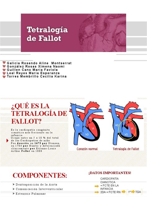 Tetralogía De Fallot Pdf Desorden Congenito Pediatría