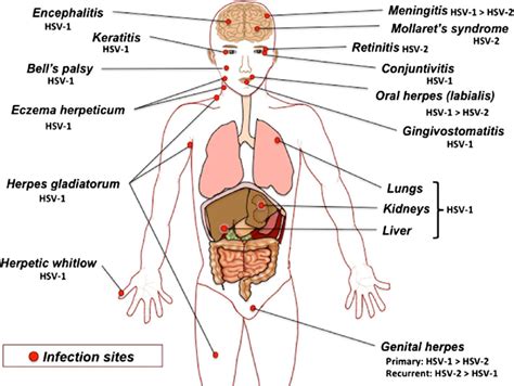 Herpes Simplex Virus 1 Hsv 1 An Overview