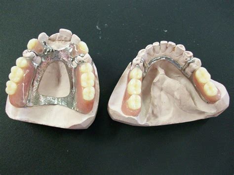 Product Offerings MegaDent Dental Outsourcing Services