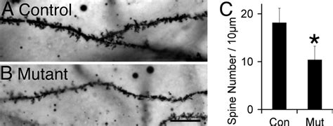 Reduced Spine Density On Pyramidal Cell Dendrites In Ca1 Sr In The Download Scientific Diagram