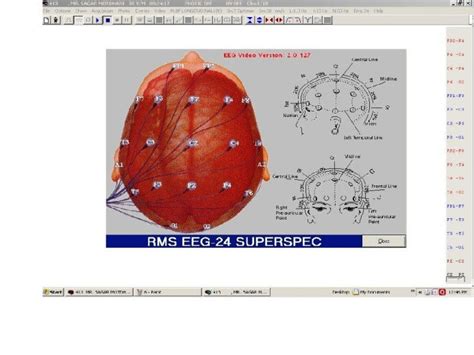 EEG Recording Procedure Download Scientific Diagram