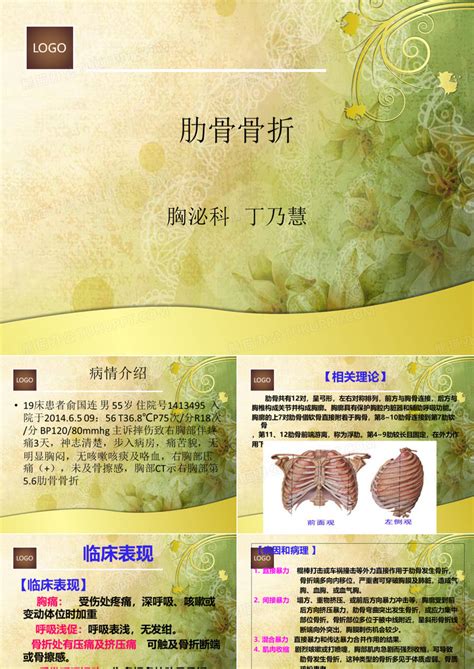 肋骨骨折PPT模板下载 编号qvbrwrox 熊猫办公