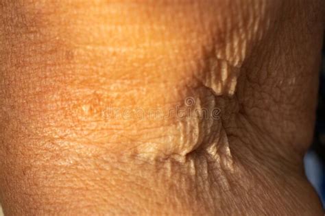 Senior Woman Wrinkled Foldable Joint Of The Arm Close Up Macro Shot