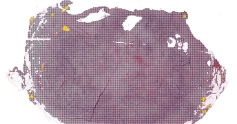 Tertiary Lymphoid Structures