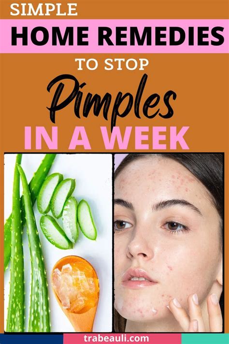How To Remove Pimples Overnight At Homediy Remedies Trabeauli