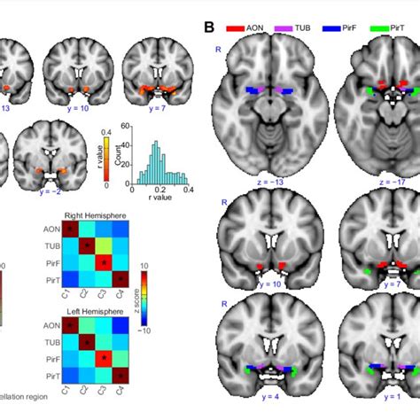Parcellation Of Primary Olfactory Cortex Combined Across Left And Right
