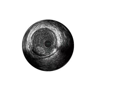 Intrasight Mobile Interventional Applications Platform Philips Healthcare