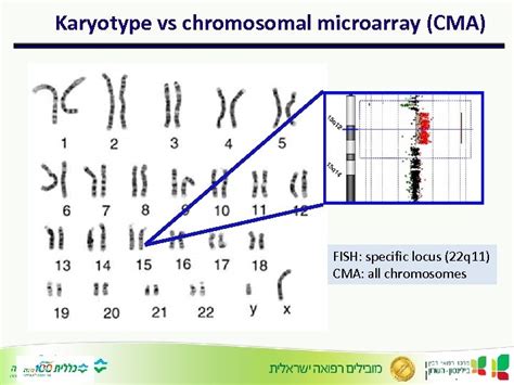 Aneuploidy Screening In Pregnancy — Modern Approaches Prof