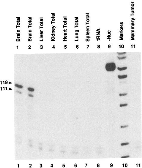Figure 1 From Brain Specific Polya Transcripts Are Detected In Polya Rna Do Complex Polya