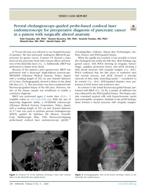 Pdf Peroral Cholangioscopyguided Probe Based Confocal Laser Endomicroscopy For Preoperative