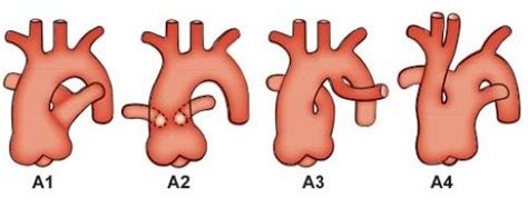 Case Of The Week 455