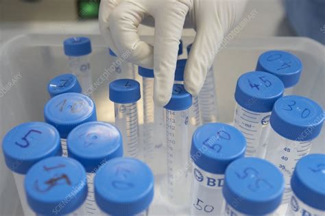 Biological Samples Stock Image C0614854 Science Photo Library