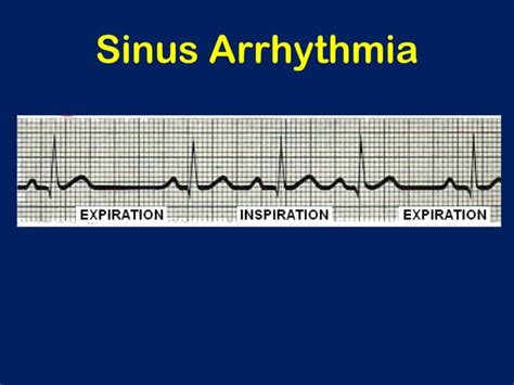 Autonomic Function Tests Ppt Lung And Respiratory Health Diseases And Conditions