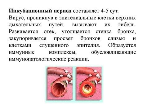 Аденовирусная инфекция презентация онлайн