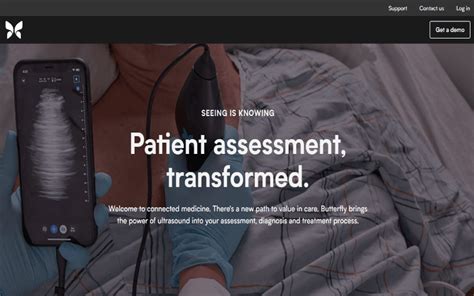 Butterfly Network Features Reviews And Alternatives