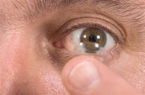 Contact Lens Related Eye Infections Send 1 Million To Doctor Annually